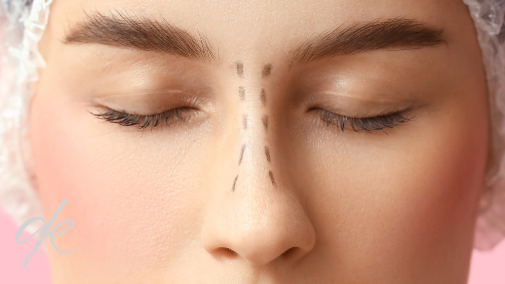 Nose Aesthetics (Rhinoplasty) Post-Operative Recovery Process - Dr ...